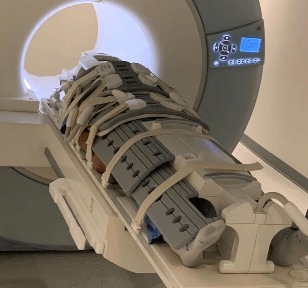 #136 - AMA #17: Body composition methods tour de force, insulin ...