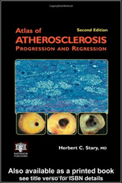#185 - Allan Sniderman, M.D.: Cardiovascular disease and why we should ...