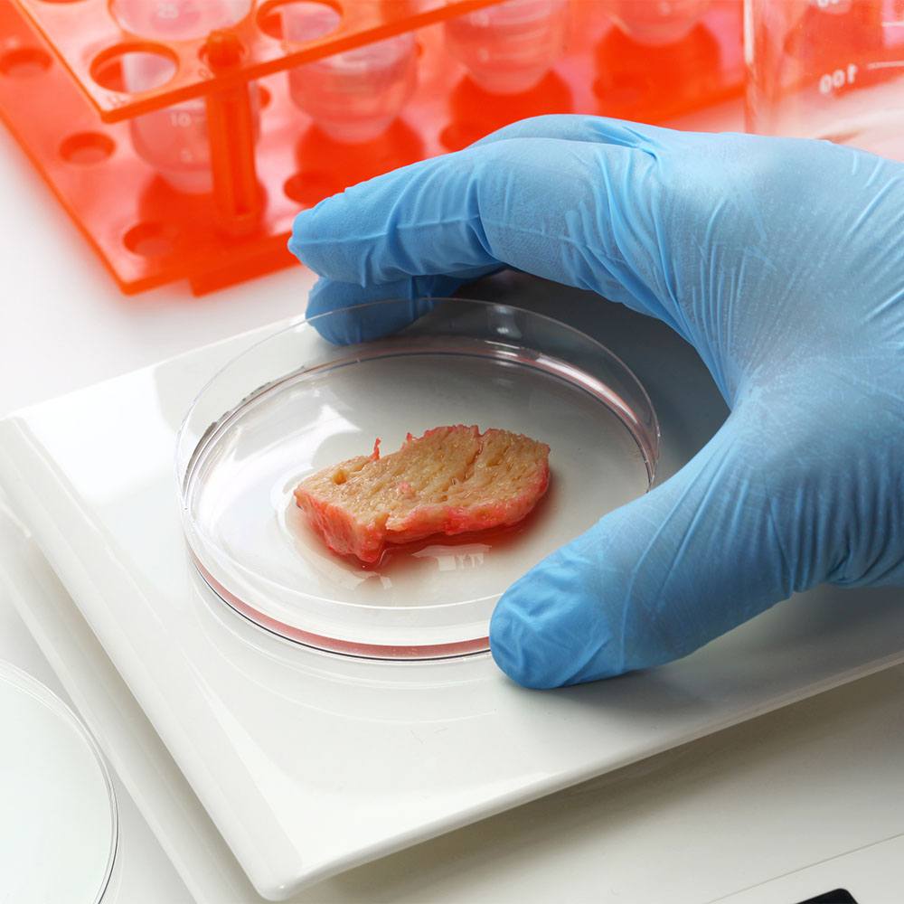 Is red meat killing us? - Peter Attia