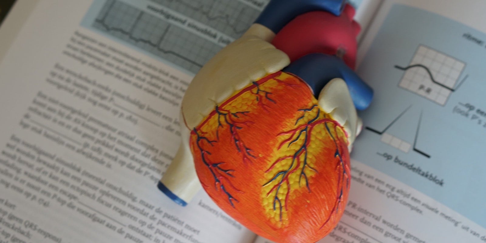 #240 ‒ The confusion around HDL and its link to cardiovascular disease ...