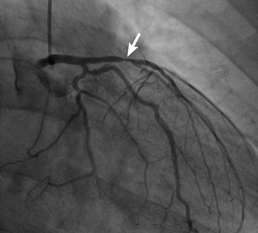 A case study on the importance of taking charge of one’s own health