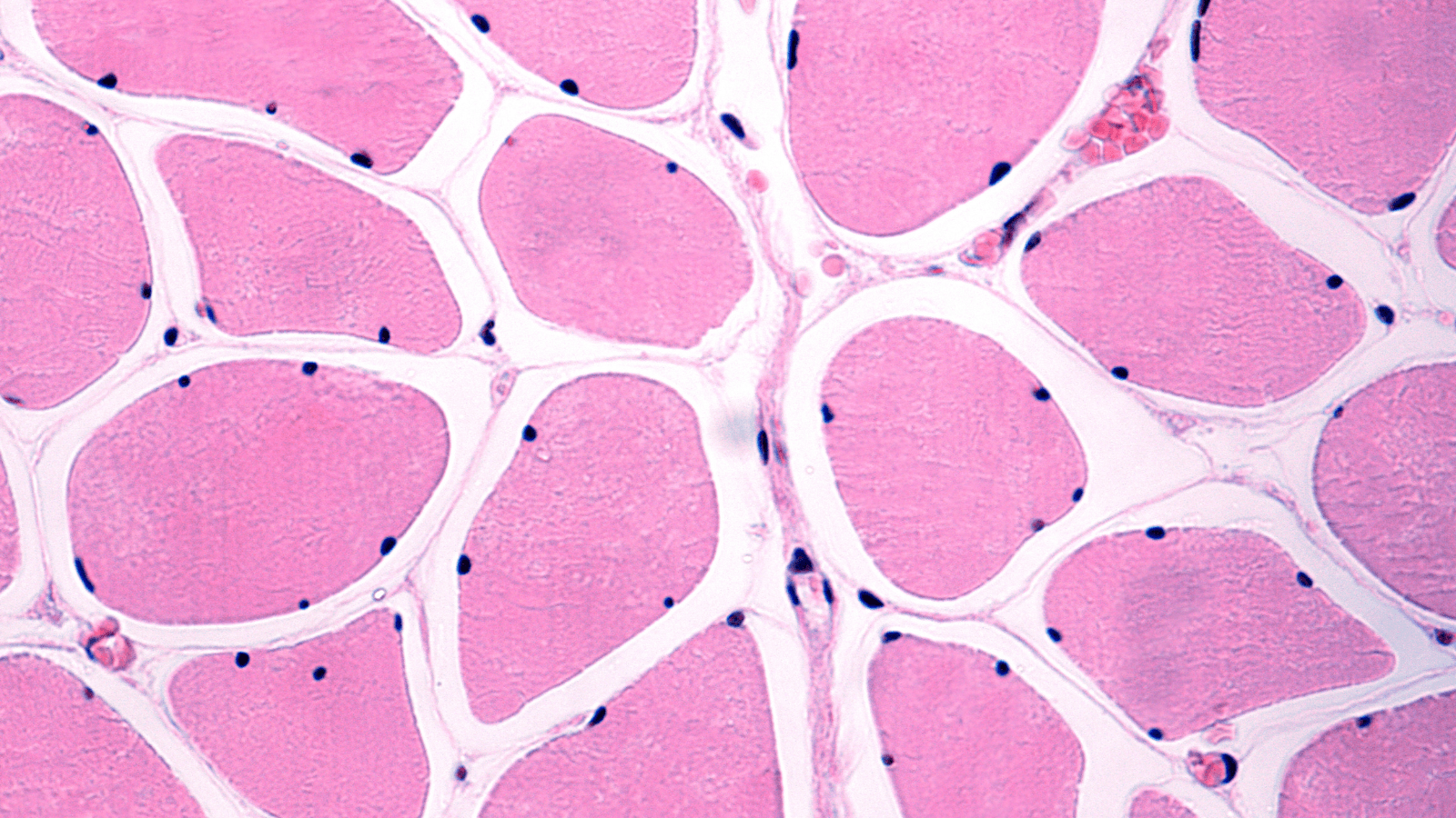 Resistance training partially reverses some of the hallmarks of aging ...