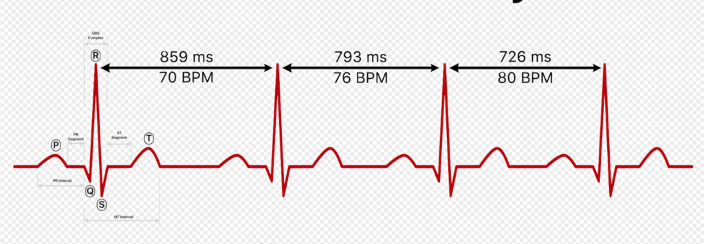 #305 ‒ Heart rate variability: how to measure, interpret, and utilize ...