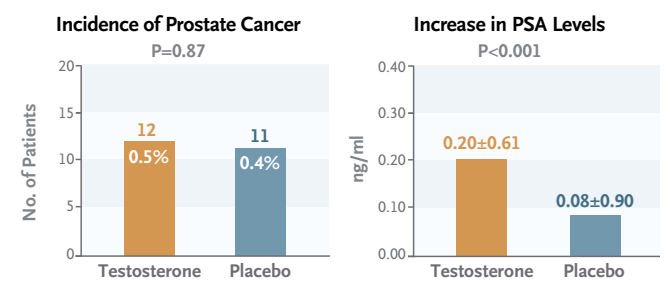 #310 - The relationship between testosterone and prostate cancer ...